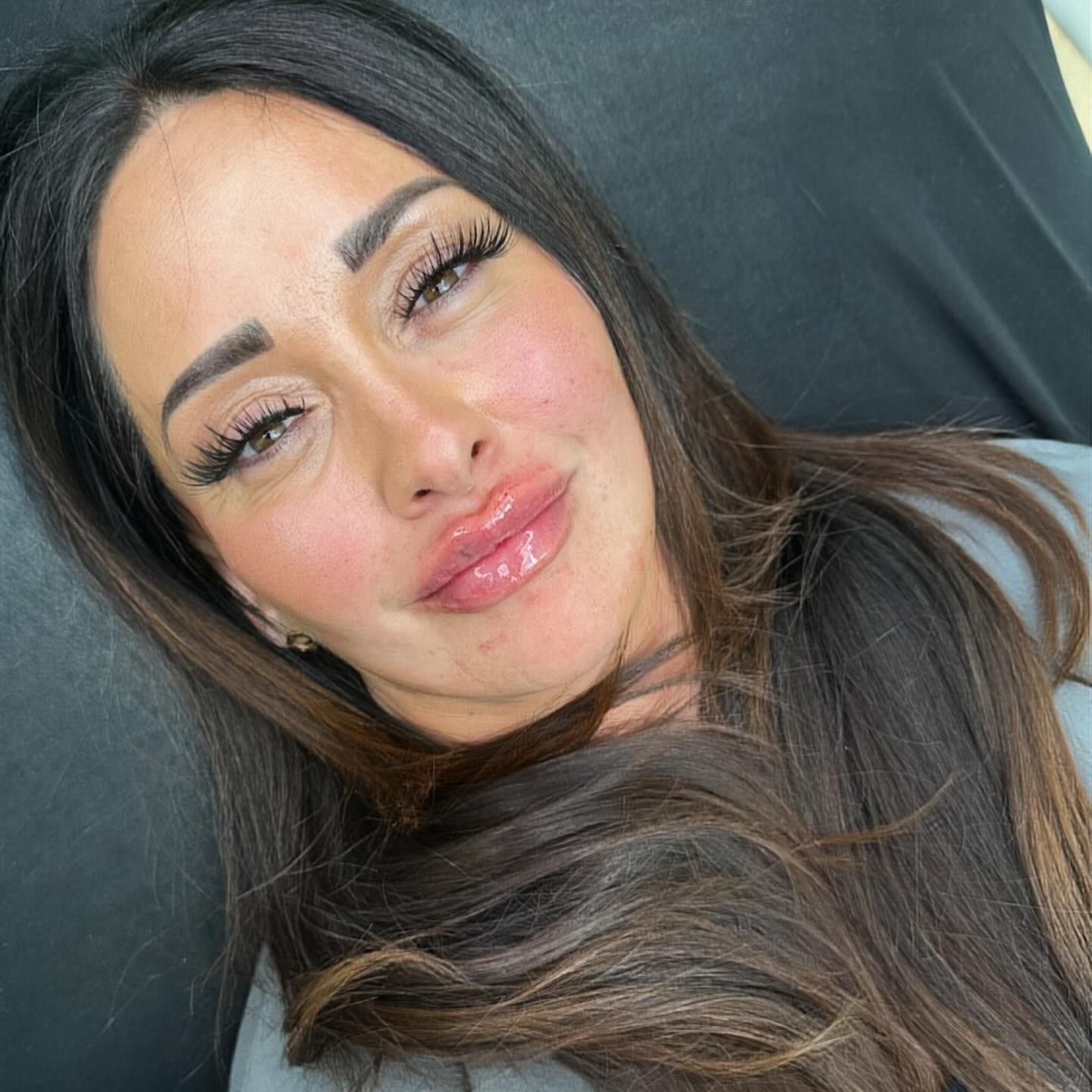 Aesthetic Treatments Weybridge | Dermal Fillers & Botox | TOX BOX